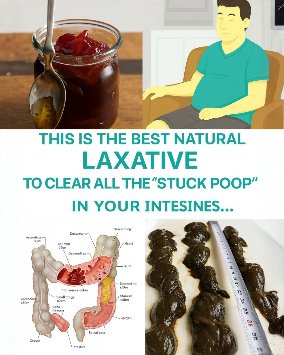 The Best Natural Laxative to Clear Out “Stuck Poop” and Reset Your Gut ...
